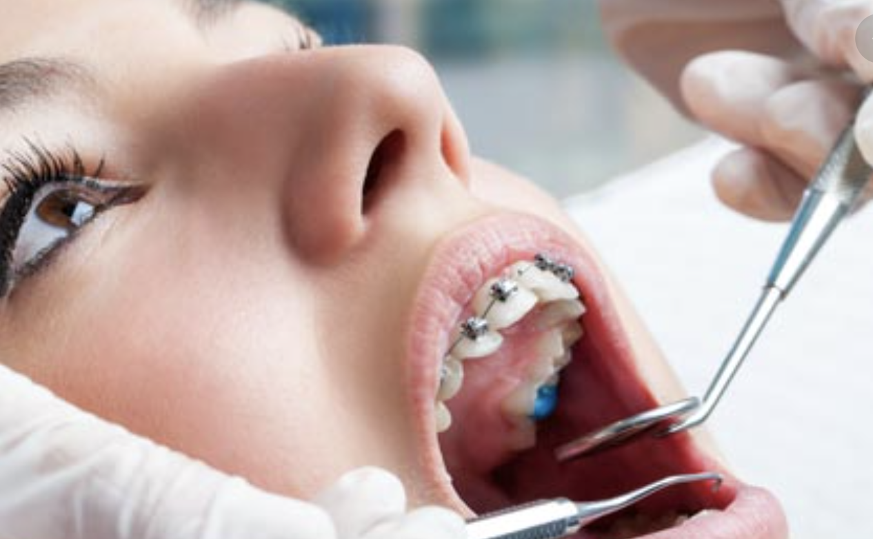 Orthodontic Assistant Course FAC Academy orthodontic-assistant-course-fac-academy